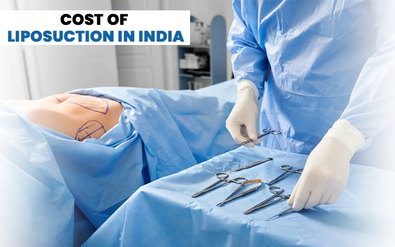 Liposuction Cost Guide for Patients | Medikaya Healthcare